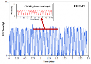 Predicting Asthma Using Carbon Dioxide Waveform Analysis – Artificial ...